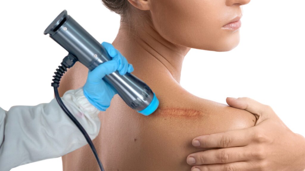 Top Shockwave Therapy Machines - Focused Therapy and Home Use