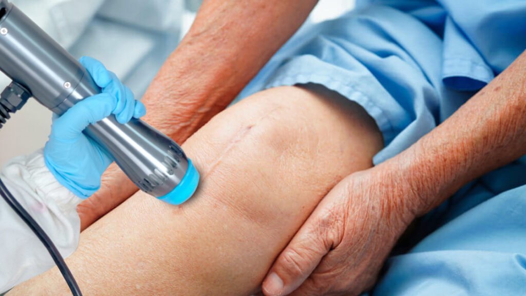 Does Shockwave Therapy Break Up Scar Tissue? — shockwavemachines ️